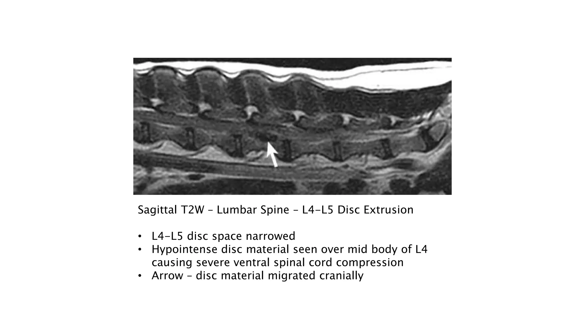 MRI of Spinal Cord.pptx MRI of Spinal Cord.pptx Veterinary medicine ...
