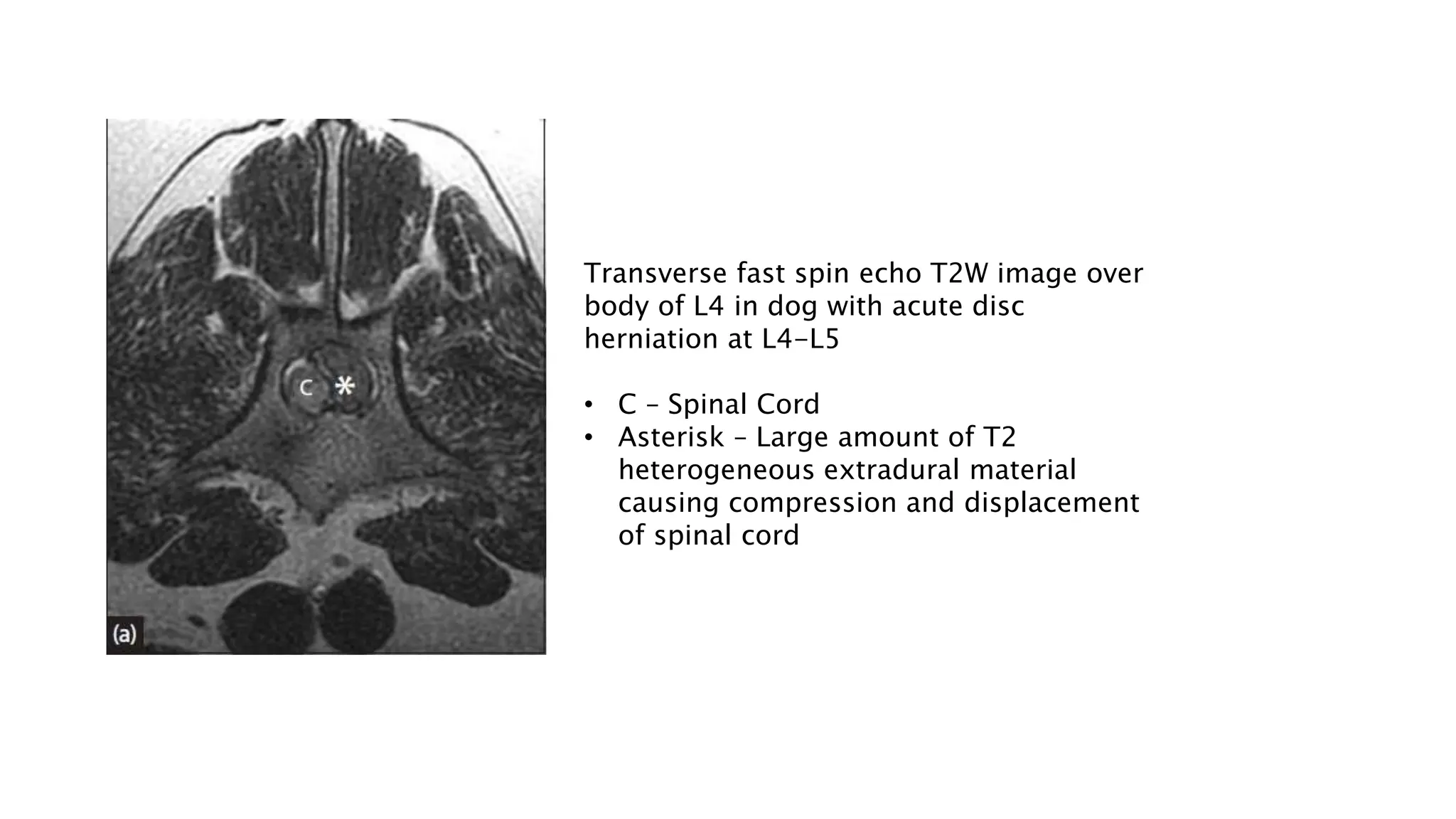 MRI of Spinal Cord.pptx MRI of Spinal Cord.pptx Veterinary medicine ...