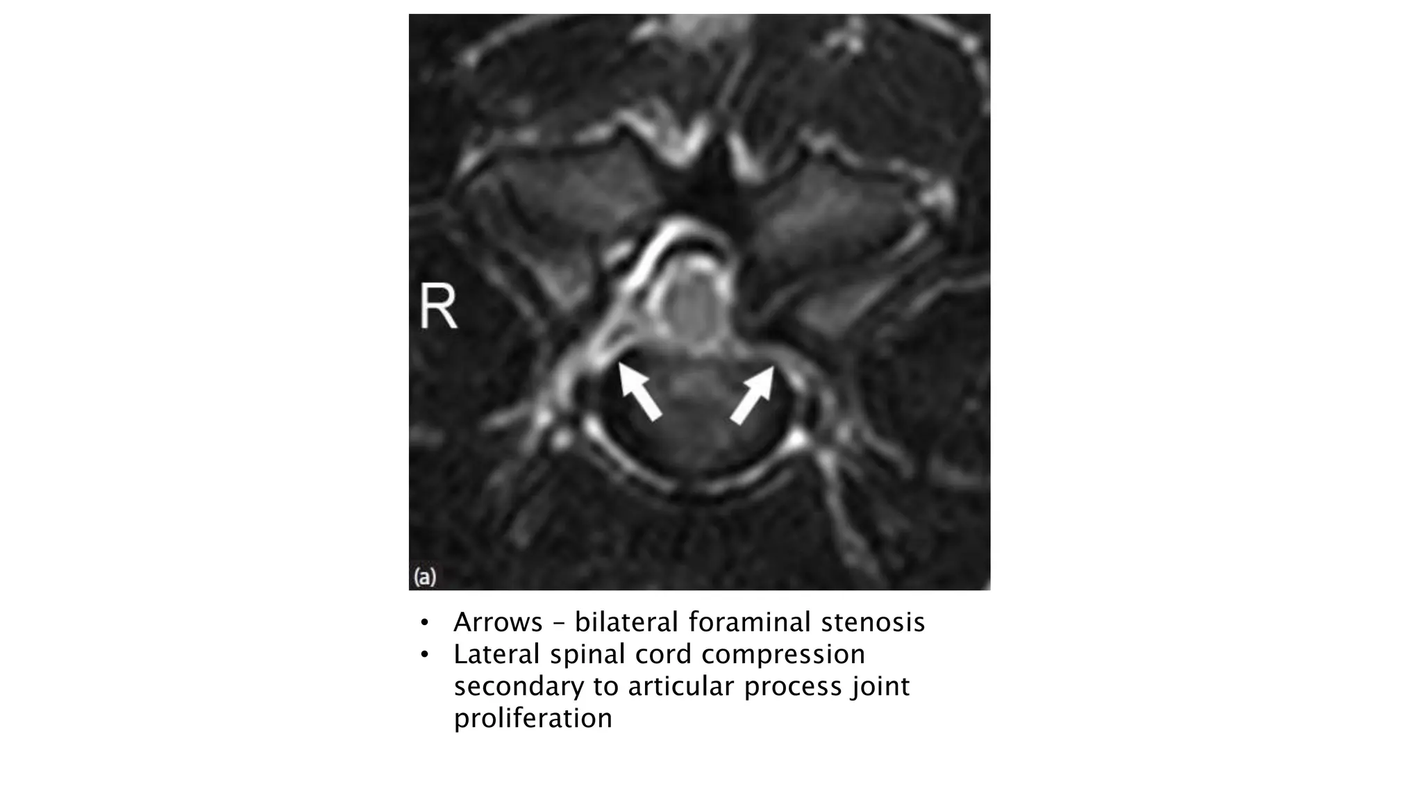 MRI of Spinal Cord.pptx MRI of Spinal Cord.pptx Veterinary medicine ...