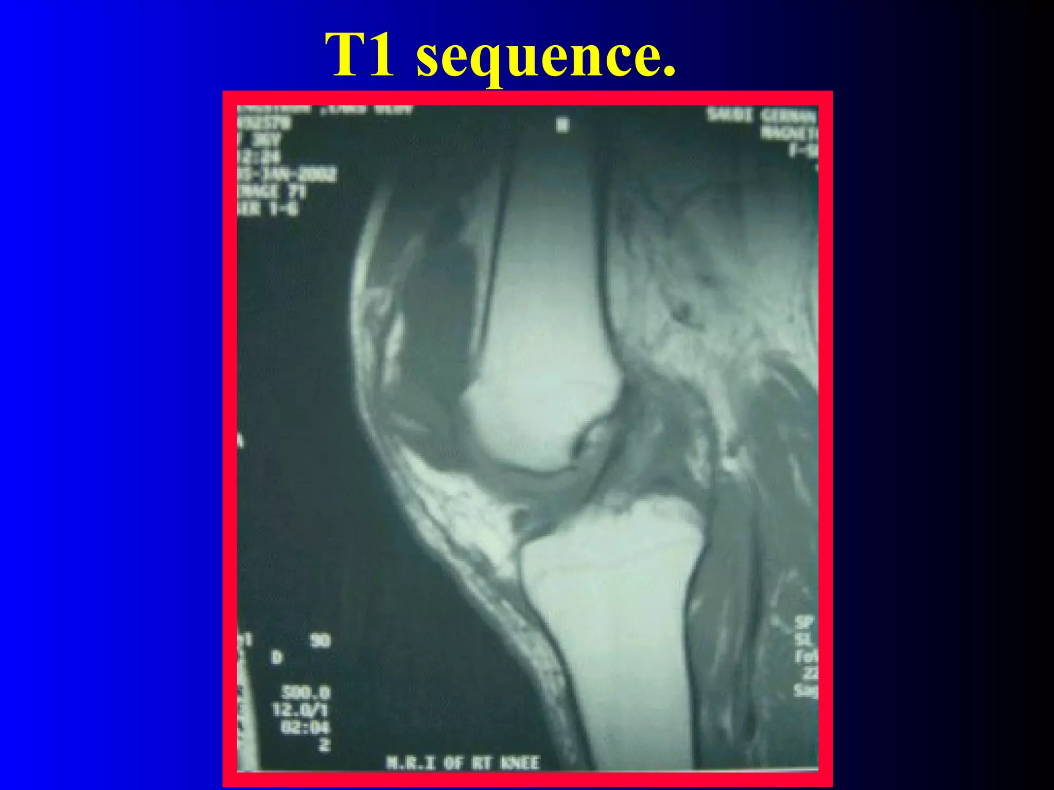 MRI of the knee.ppt