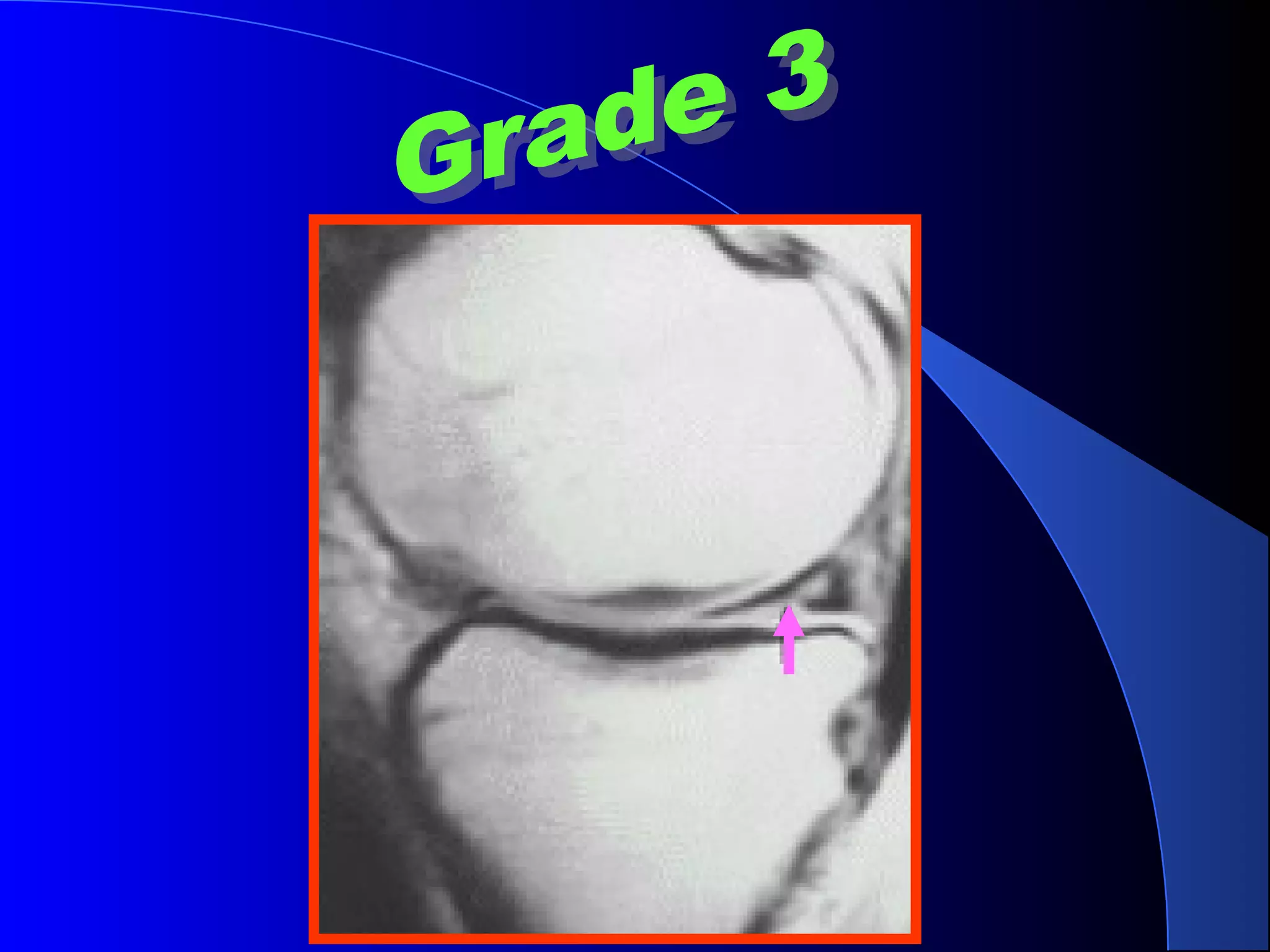 MRI of the knee.ppt