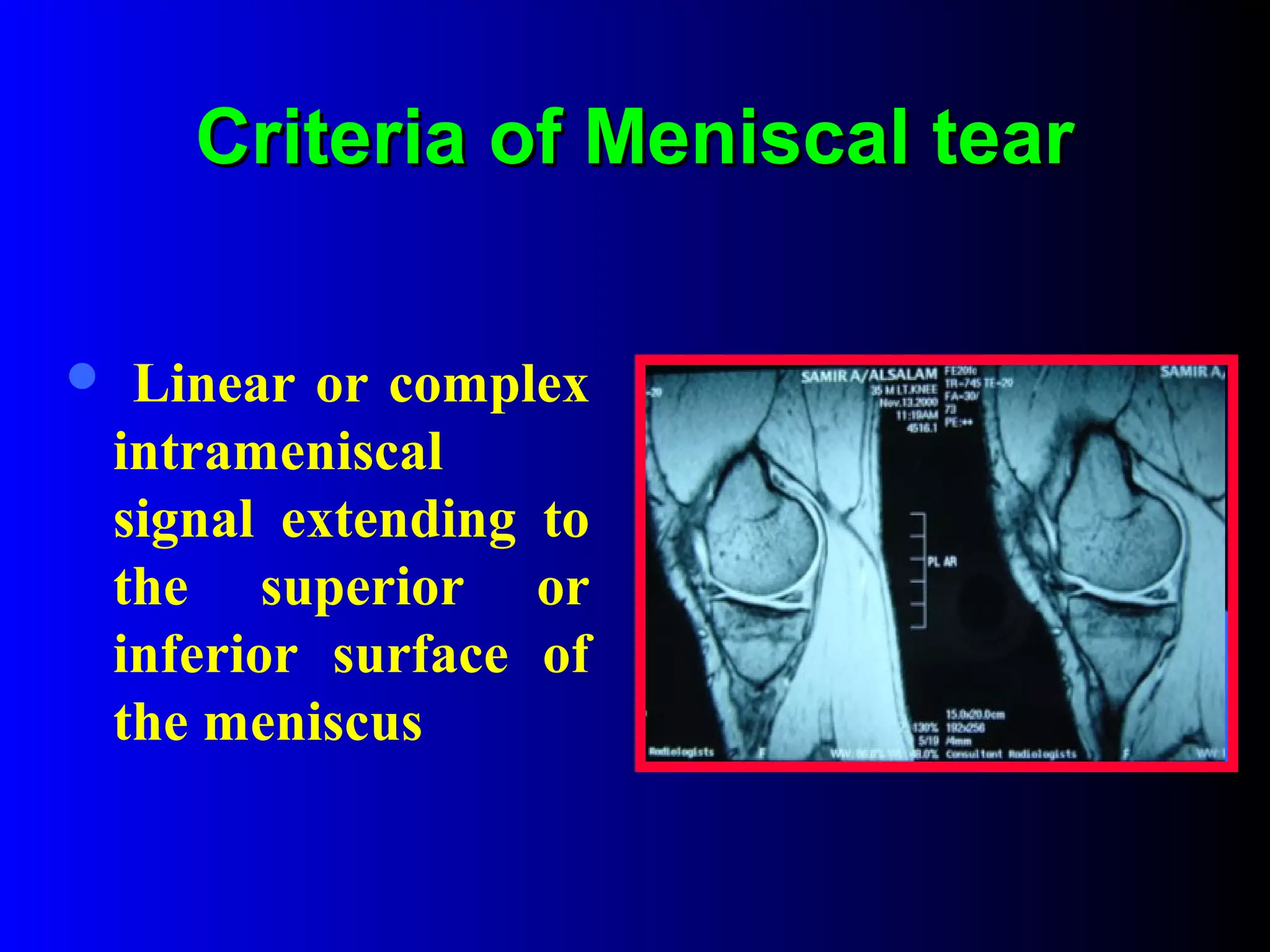 MRI of the knee.ppt