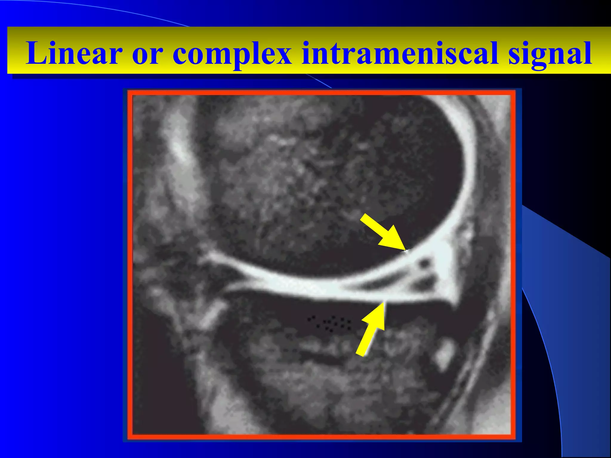 MRI of the knee.ppt