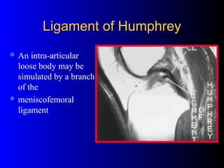 MRI of the knee.ppt