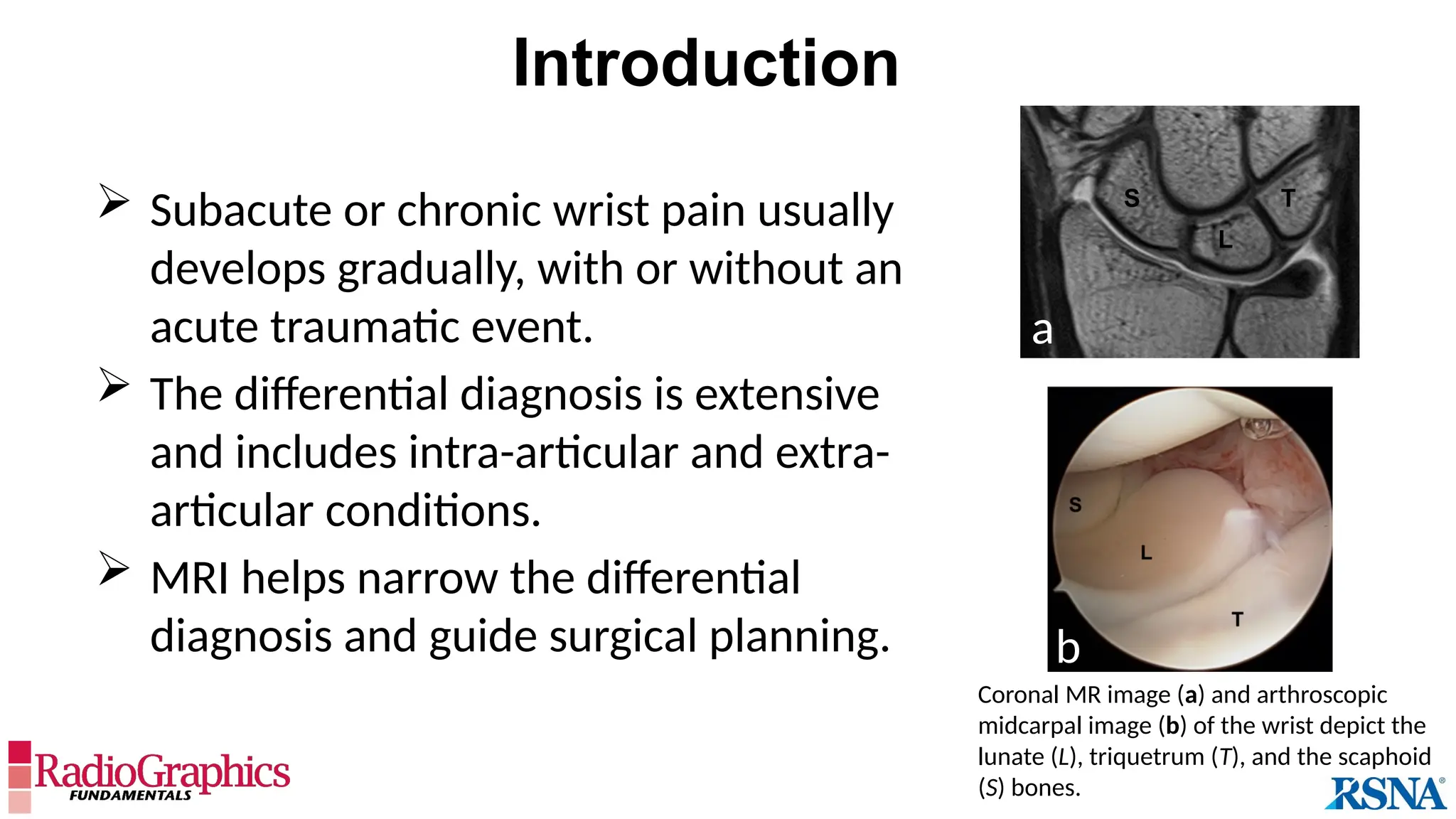 MRI of the Wrist Algorithmic Approach for Evaluating Wrist Pain.pptx