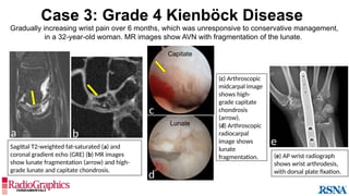 MRI of the Wrist Algorithmic Approach for Evaluating Wrist Pain.pptx