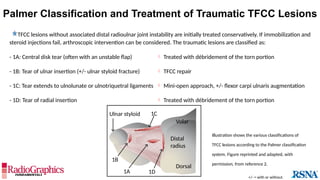 MRI of the Wrist Algorithmic Approach for Evaluating Wrist Pain.pptx