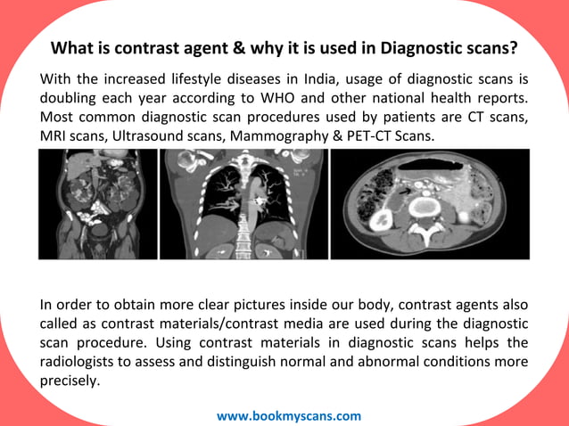 9 Things you should know! Contrast Scans - MRI (or) CT | PPT