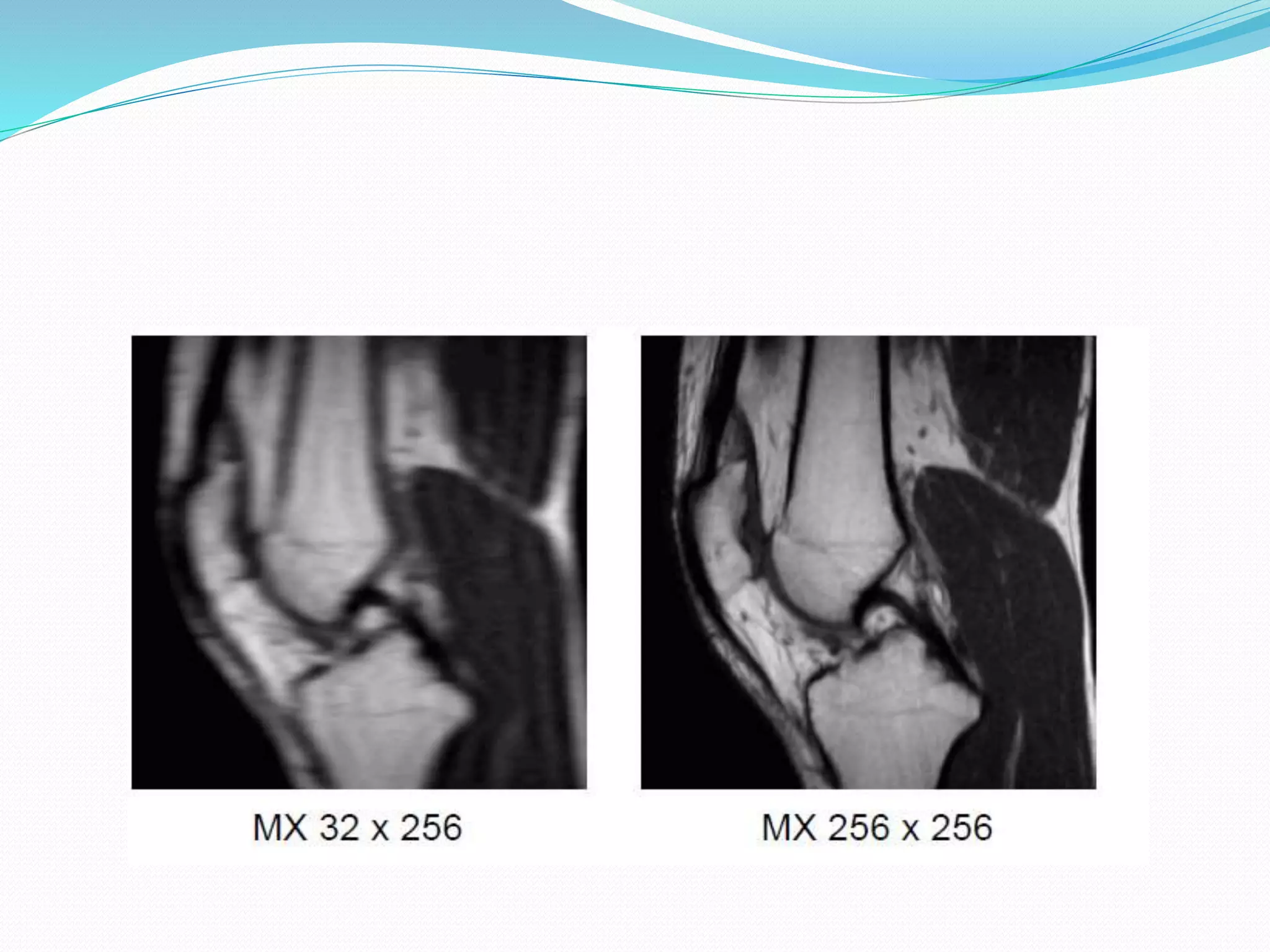 MRI Parameters for Imaging | PPTX