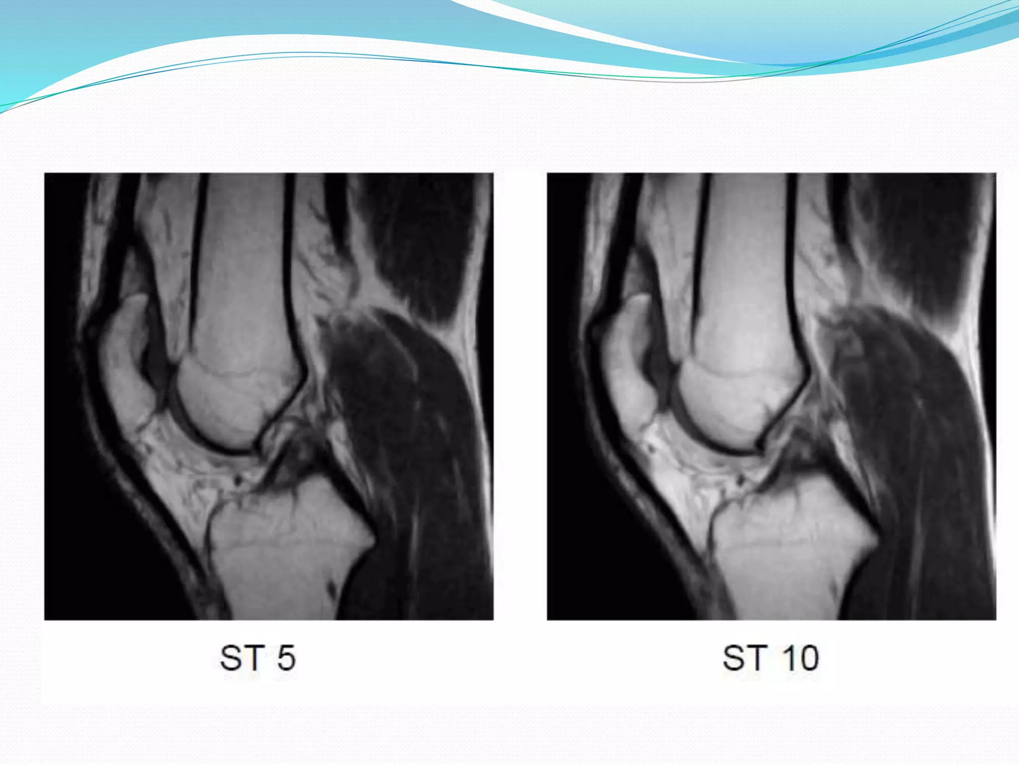 MRI Parameters for Imaging | PPTX