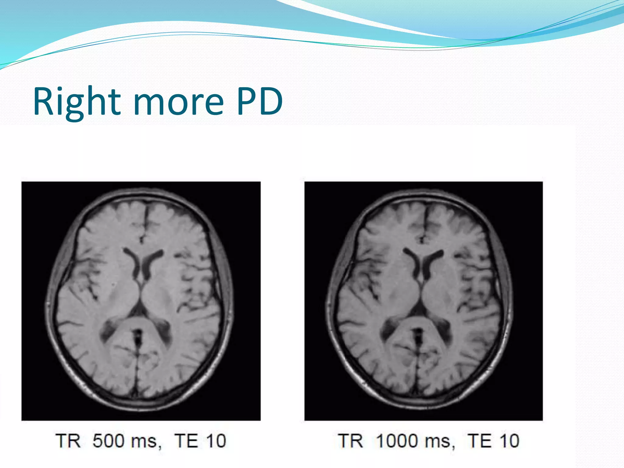 MRI Parameters for Imaging | PPTX