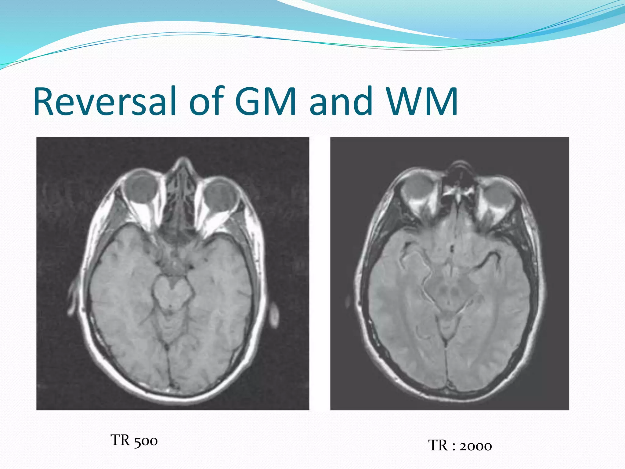 MRI Parameters for Imaging | PPTX