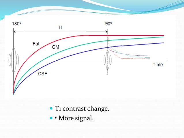 MRI Parameters for Imaging | PPTX