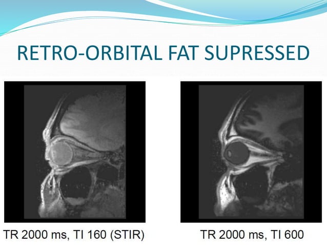 MRI Parameters for Imaging | PPTX