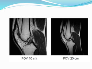 MRI Parameters for Imaging | PPTX