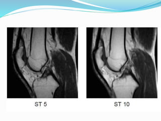 MRI Parameters for Imaging | PPTX