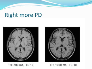 MRI Parameters for Imaging | PPTX