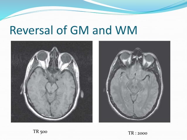MRI Parameters for Imaging | PPTX