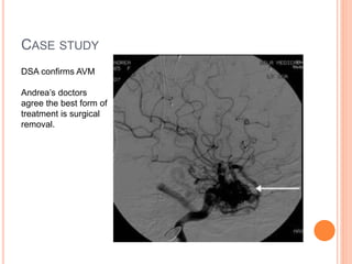 Mri patho avm | PPTX | Brain and Nervous System Disorders | Diseases ...