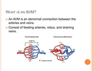 Mri patho avm | PPTX | Brain and Nervous System Disorders | Diseases ...