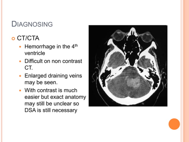 Mri patho avm | PPTX | Brain and Nervous System Disorders | Diseases ...