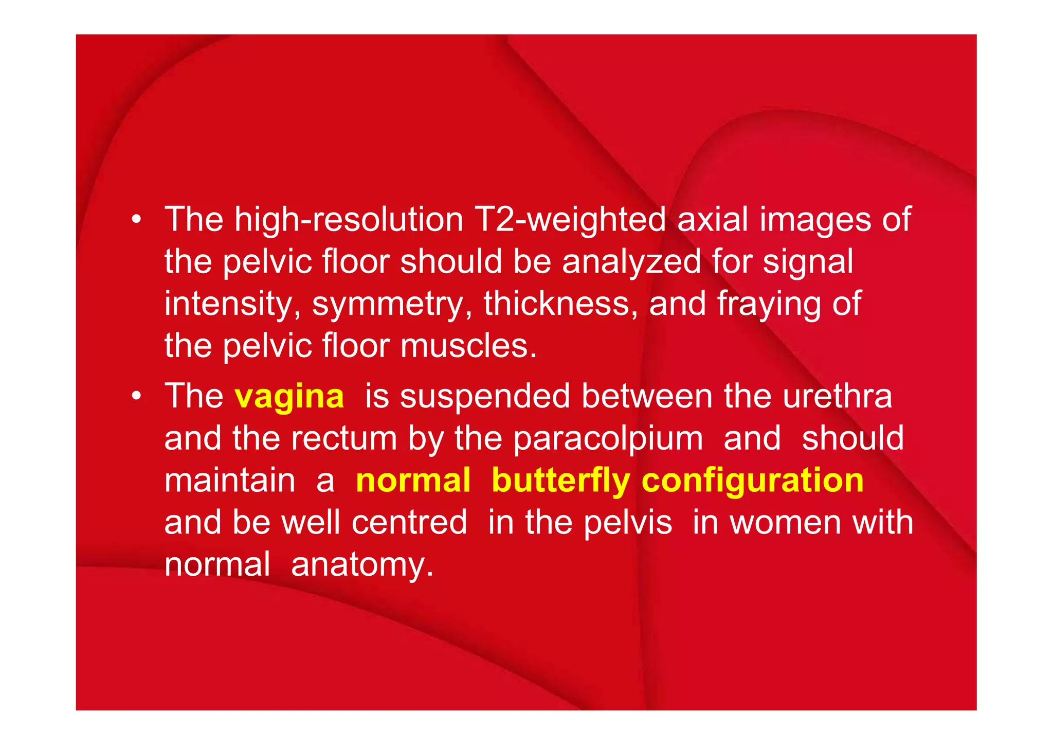 Mri Pelvic Floor