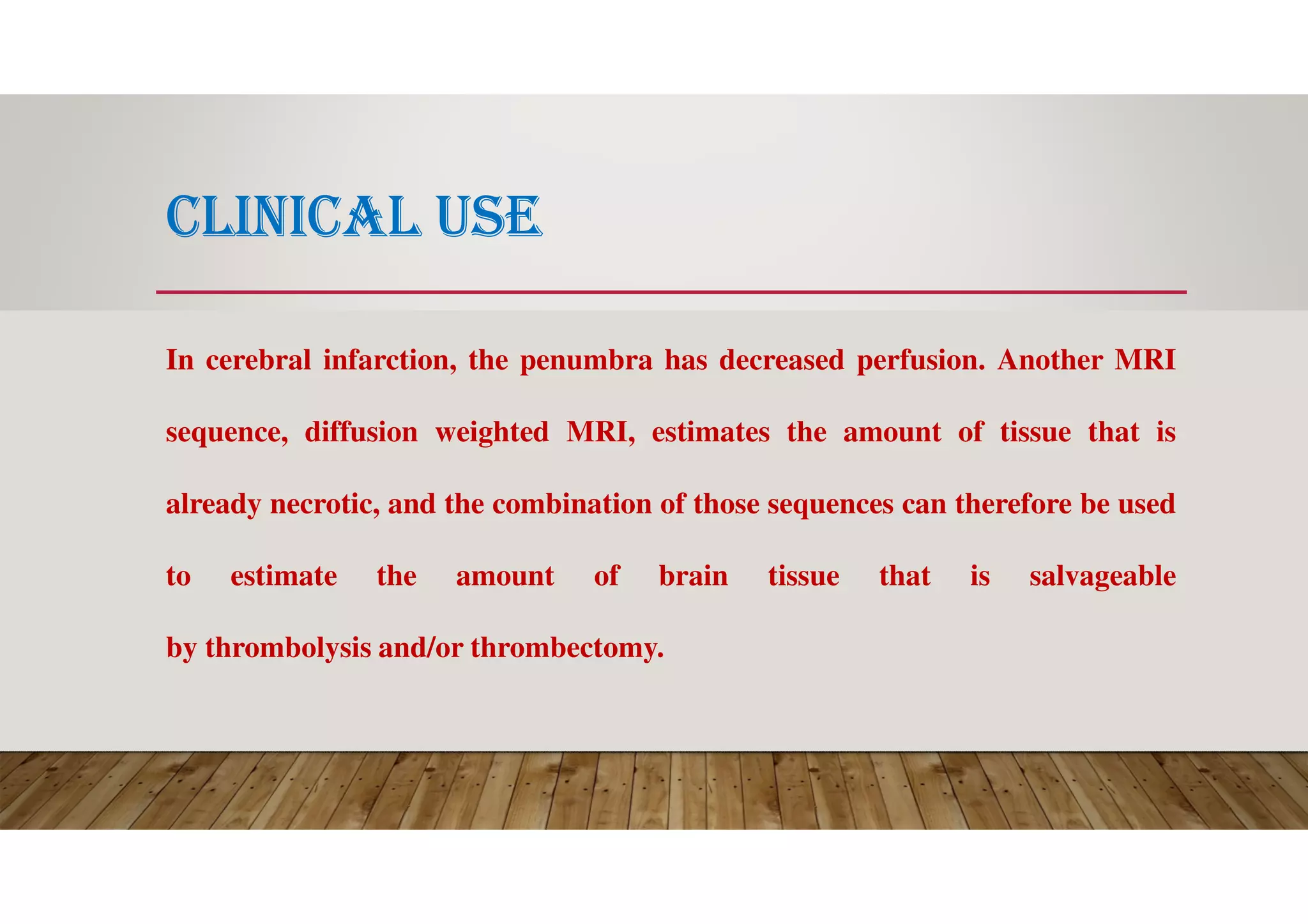 MRI PERFUSION.pdf