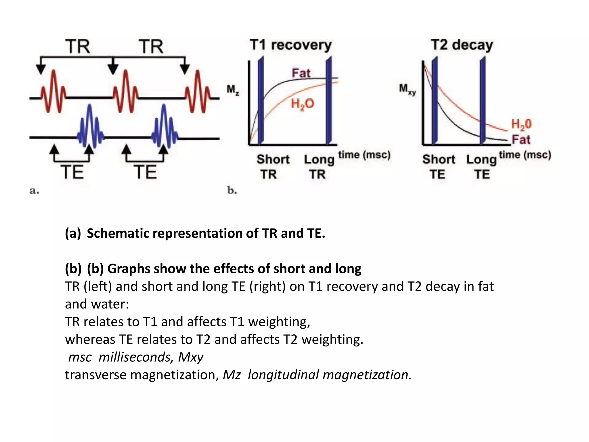 mri physics.pptx