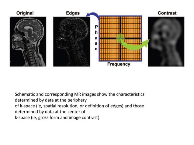 mri physics.pptx