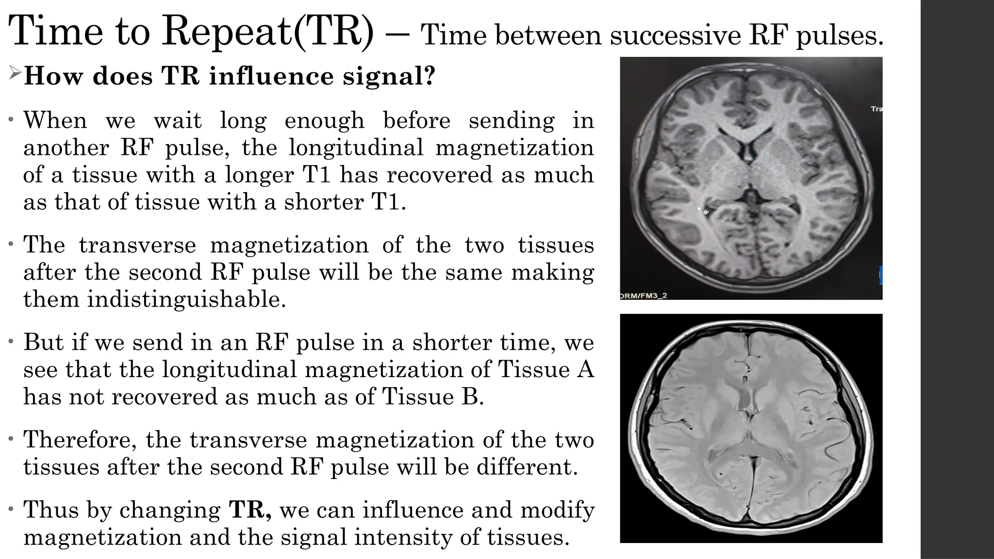 MRI PHYSICS Basics and Principle with T1 T2 PD imaging, | PPTX