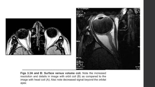 MRI PHYSICS Basics and Principle with T1 T2 PD imaging, | PPTX