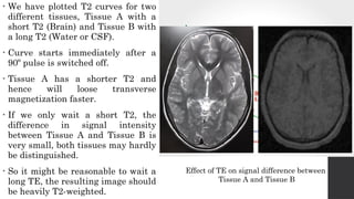 MRI PHYSICS Basics and Principle with T1 T2 PD imaging, | PPTX