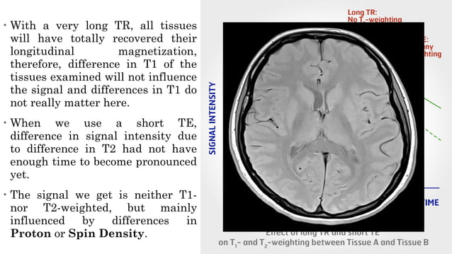 MRI PHYSICS Basics and Principle with T1 T2 PD imaging, | PPTX