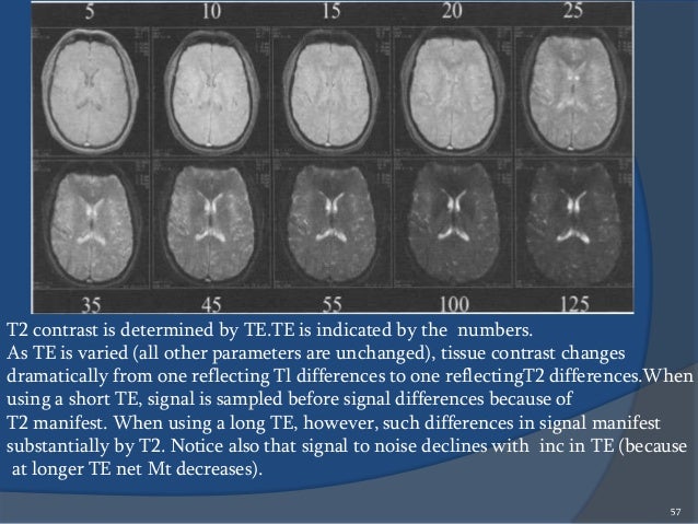 Mri physics PART-1