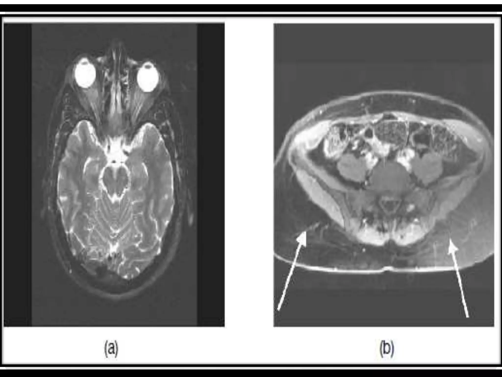 Mri physics ii | PPTX