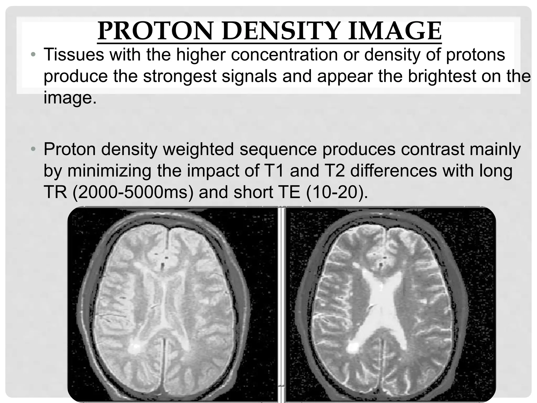 Mri physics ii | PPTX