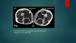 MRI physics part 1: Basic principle by GKM | PPTX