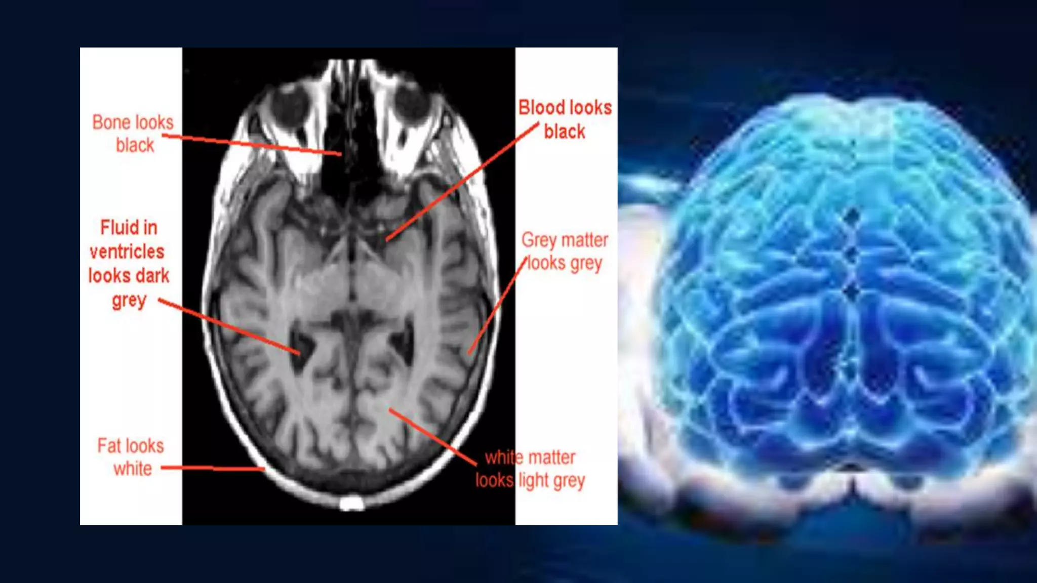 MRI Physics RV | PPTX