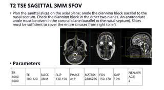 MRI PNS PLANNING - SHUBHASHIS MONDAL MRIT | PPTX