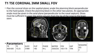 MRI PNS PLANNING - SHUBHASHIS MONDAL MRIT | PPTX