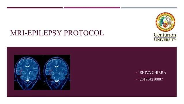 MRI Epilepsy protocol | PPTX | Brain and Nervous System Disorders ...