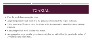 MRI Epilepsy protocol | PPTX
