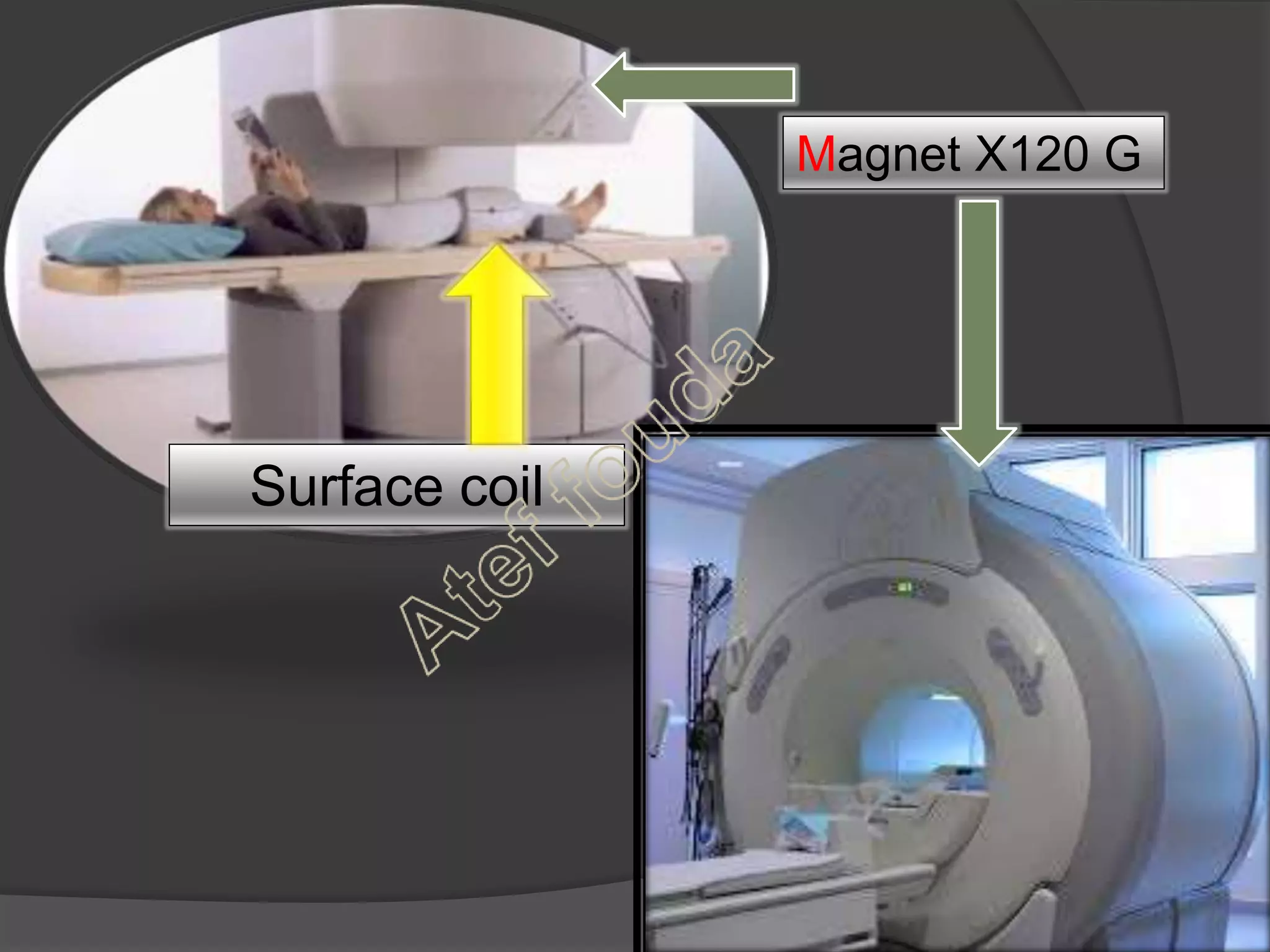 MRI for the maxillofacial surgeon. | PPSX