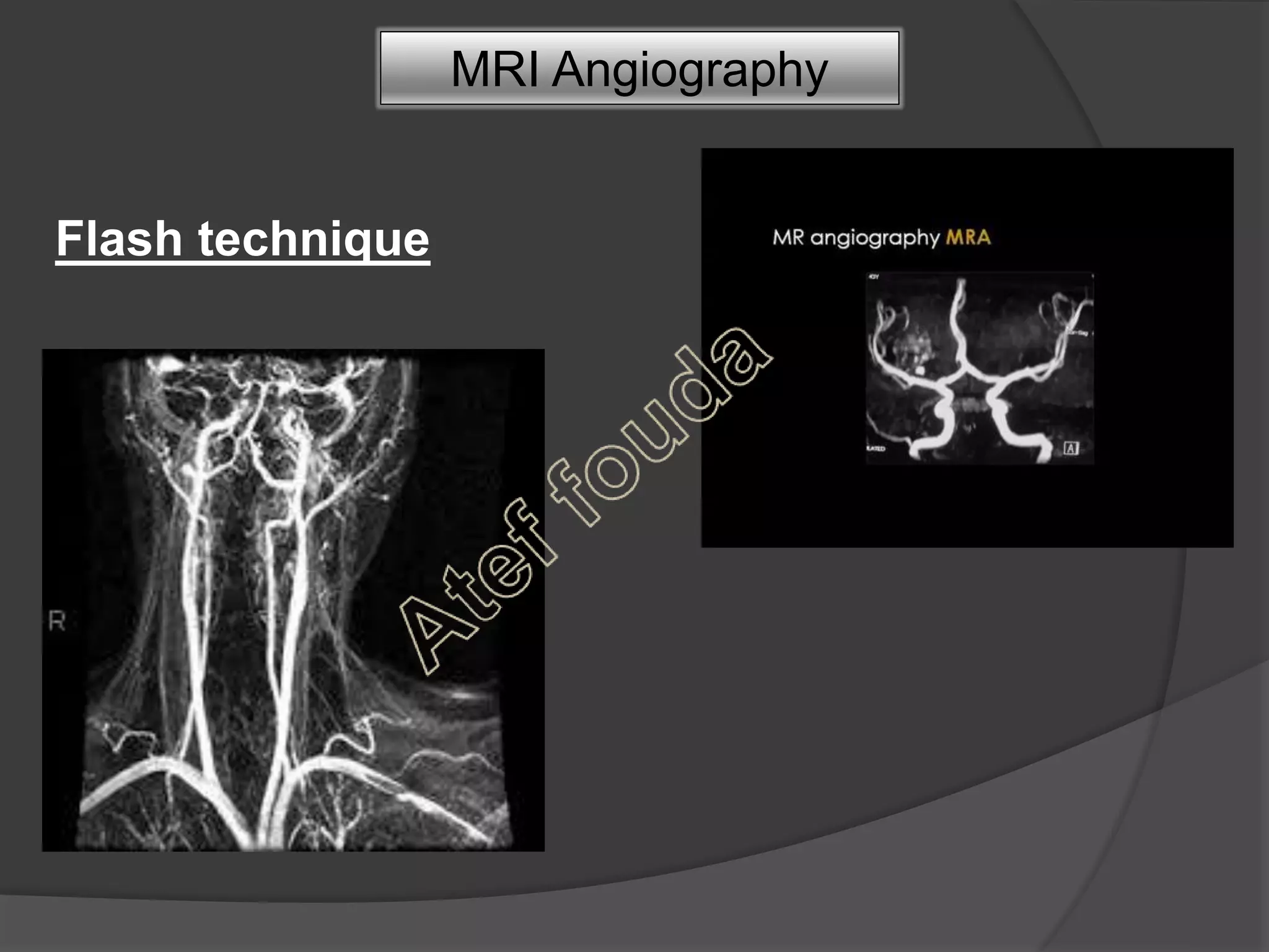 MRI for the maxillofacial surgeon. | PPSX