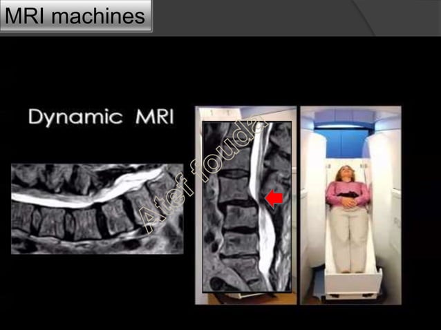 MRI for the maxillofacial surgeon. | PPSX | Blood Disorders | Diseases ...