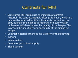 Presentation on MRI of human brain in detail | PPTX