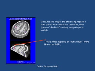 Presentation on MRI of human brain in detail | PPTX