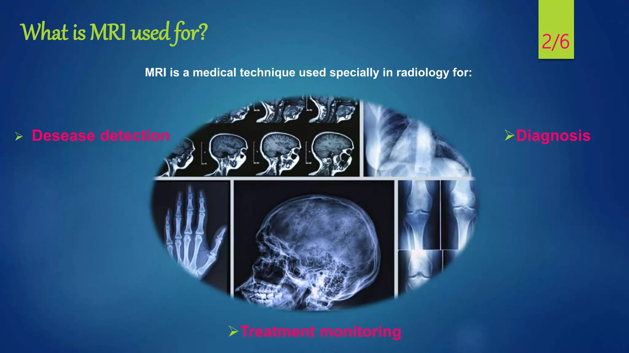 MRI_presentation 3.pptx