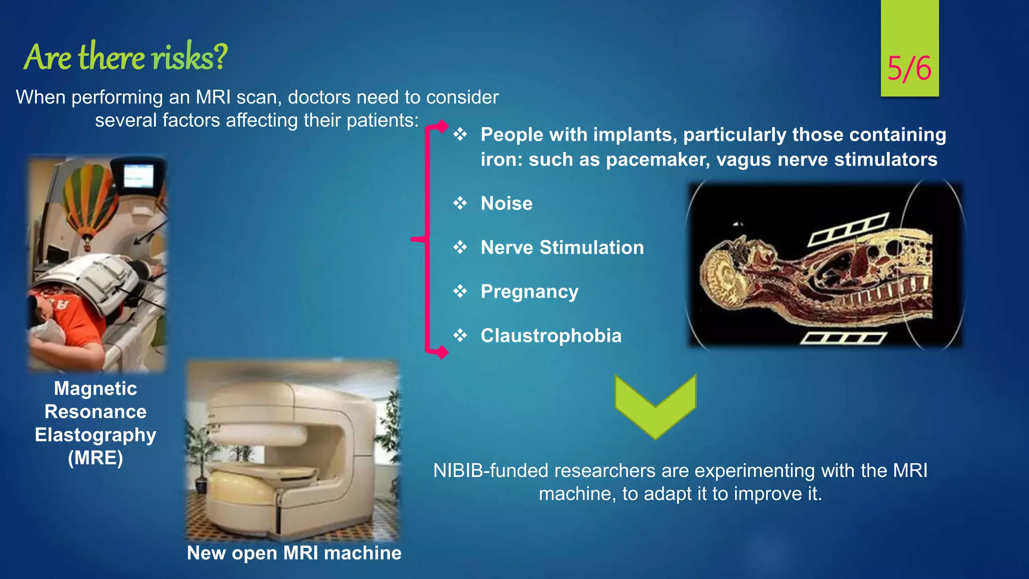 MRI_presentation 3.pptx