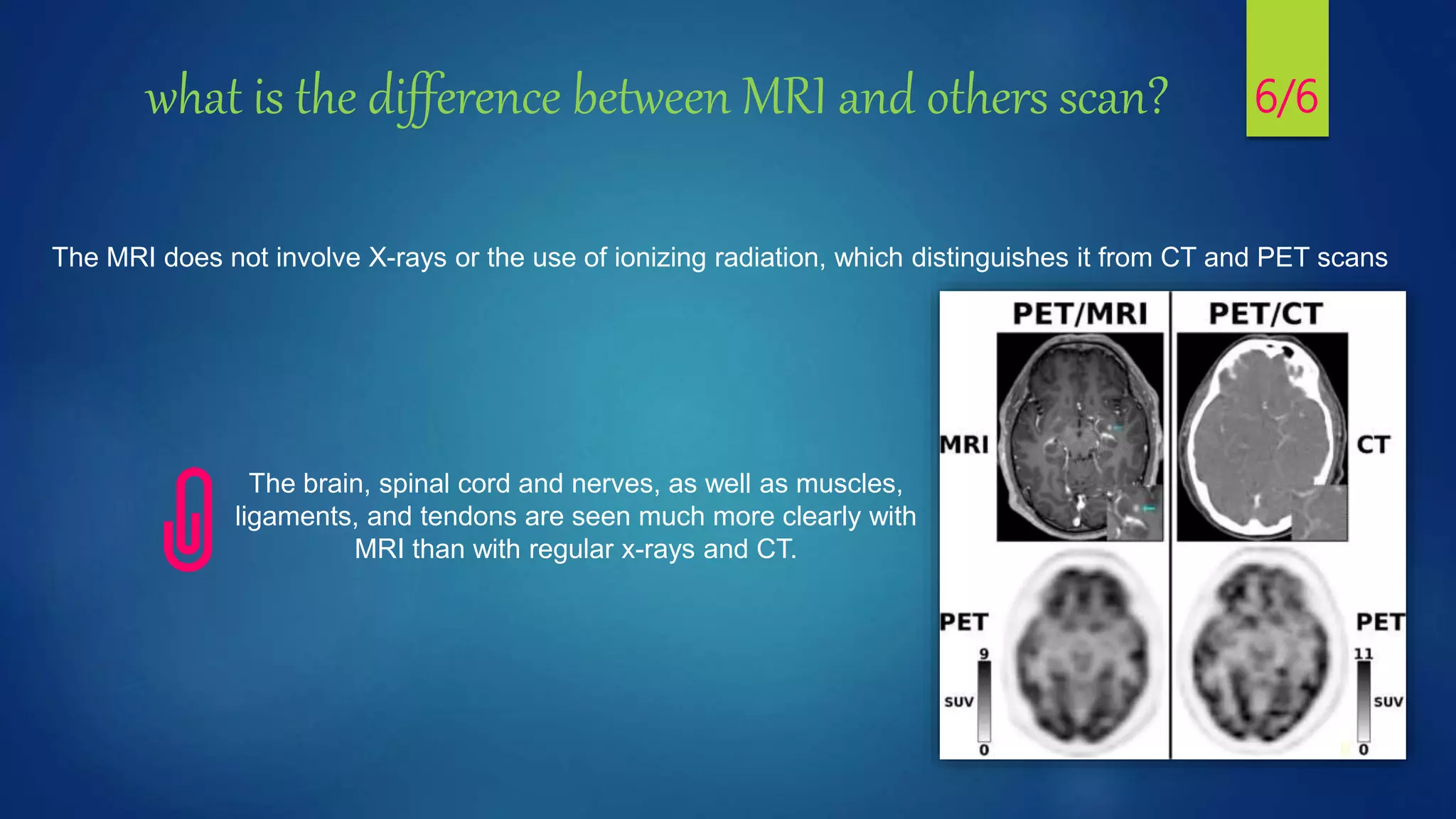 MRI_presentation 3.pptx